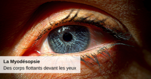 La myodésopsie, des corps flottants devant les yeux ! | Eyes-Road - Une ...